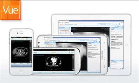 vue motion fda clearance carestream