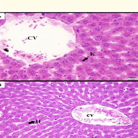 A Light Microscopy Micrograph Of Liver Tissue From Control Group