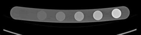 Bone Density Calibration Phantoms A Ptw Company