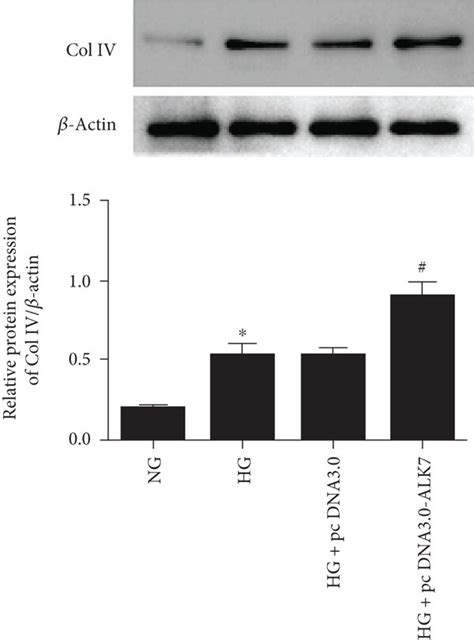 Alk7 Enhances Hg Induced Production Of Ros Inflammatory Cytokines And