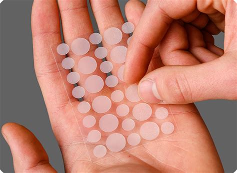 Acne Patch Skin Solution