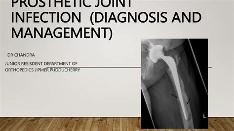 Prosthetic Joint Infectiondiagnosis And Management Pptx