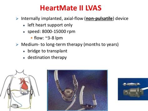 Lvad Left Ventricular Assist Device