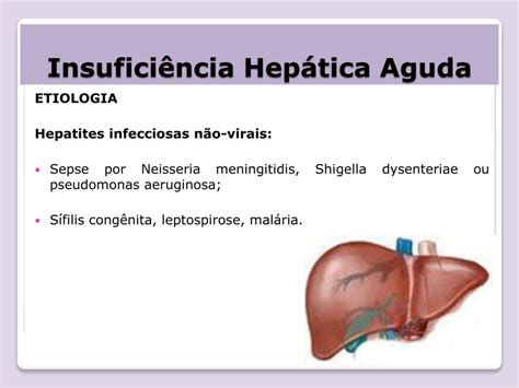 PPT Insuficiência Hepática Aguda PowerPoint Presentation free