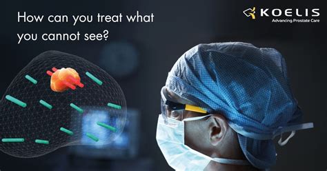 Koelis On Linkedin Fusion Prostate Biopsy Advancing Prostate Care
