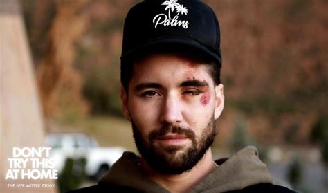 David Dobrik And Jeff Wittek Had A Falling Out Over Wittek S Eye Injury