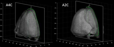 Result Of The 3d 2d Registration Step Described In Sect Ii C After