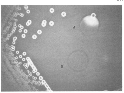 Figure 1 From Evaluation Of The Spot Camp Test For The Rapid