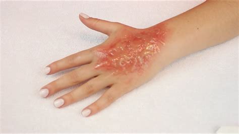 Acid Burn Sfx Makeup Tutorial Youtube