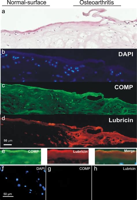 Lubricin Antibody Pa3 118