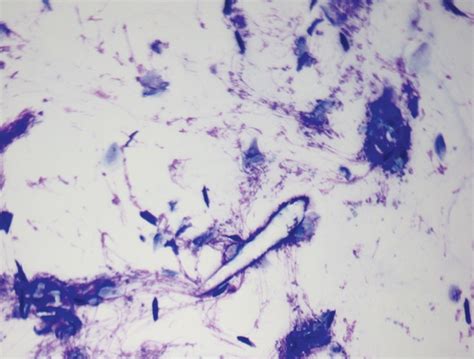 Dermatology Diagnostics Cutaneous Cytology Todays Veterinary Practice