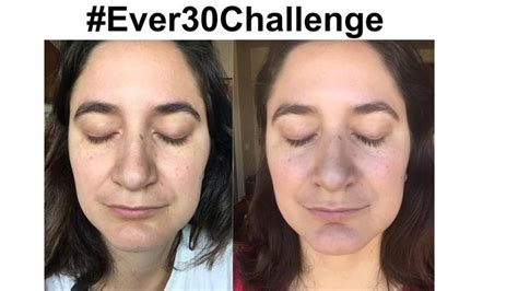 Transform Your Skin With Ever Skincare