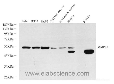 High Affinity And Specificity Mmp13 Polyclonal Antibody E Ab 70346 At