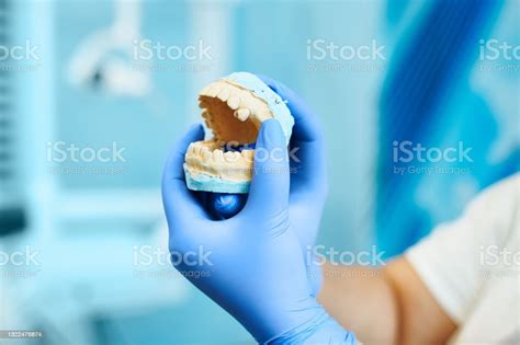 치과 의사는 개별 석고 치과 금형을 들고 석고 턱 캐스트 개념에 대한 스톡 사진 및 기타 이미지 개념 건강 진단 건강관리와 의술 Istock