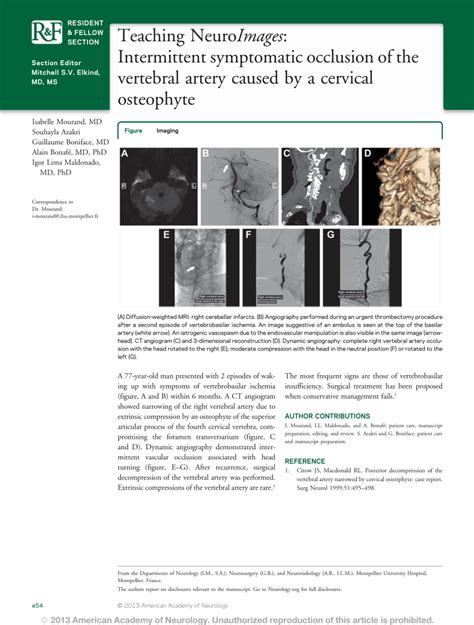 PDF Teaching NeuroImages Intermittent Symptomatic Occlusion Of The