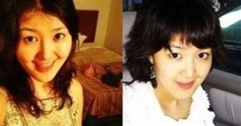 이시영 성형 인정 이유 통통 얼굴 달라진 얼굴 윤곽 반전 과거