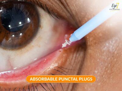 What Are Punctal Plugs Overview Types Procedure And Cost
