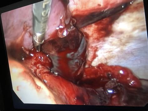 Ховд Ховд аймаг дахь Бүсийн Оношилгоо Эмчилгээний Төв