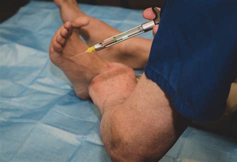 Lesser Toe Surgery Find A Local Podiatrist Near Me