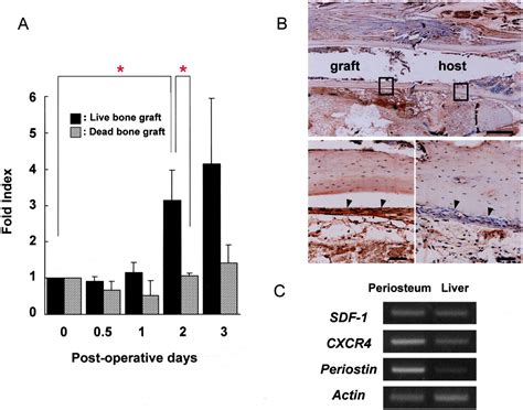 Stromal Cellderived Factor 1 CXCR4 Signaling Is Critical For The