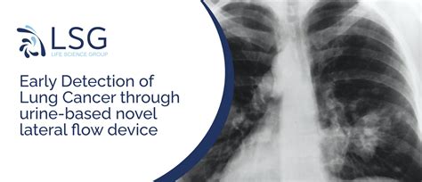 Life Science Group To Aid In Earlier Lung Cancer Detection Life