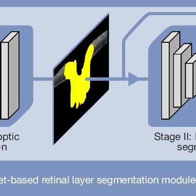 Summary Of An MGU Net Based Retinal Layer Segmentation Model