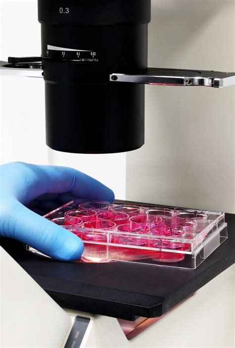 Plaque Reduction Neutralization Tests Prnt And The Development Of New