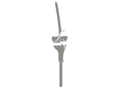 Proximal Tibial Replacement Manufacturer Yubmedtech