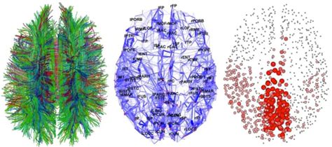 Diffusion Tensor Tractography Left Graph Of Connectivity Center