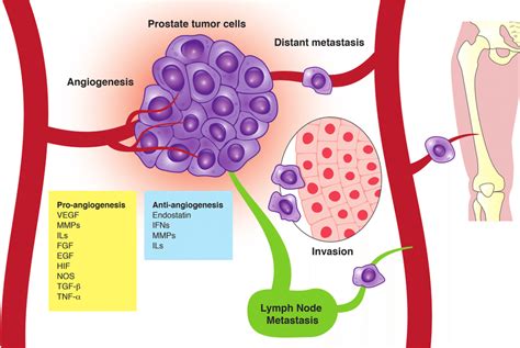 Angiogenesis In Cancer Presentation