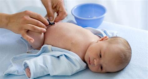 Как правильно обрабатывать пупок у новорождённого если он кровит и мокнет