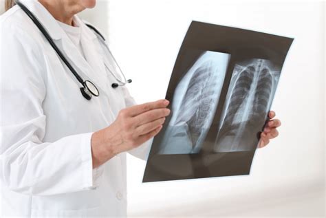 Biaya Rontgen Terbaru Panduan Lengkap Untuk Semua Kalangan