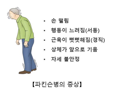 파킨슨병 다 아시죠 캐시닥 커뮤니티