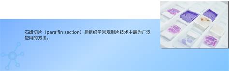 Zc Hplc Nta