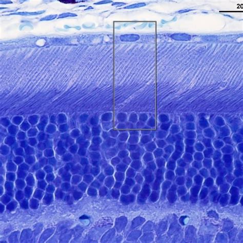 The Interface Of Rpe And Photoreceptor Cells In Albino Mouse Retina