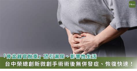反覆陰道炎、性生活受影響，恐是骨盆器官脫垂！台中榮總創新微創手術接軌國際新趨勢 蕃新聞