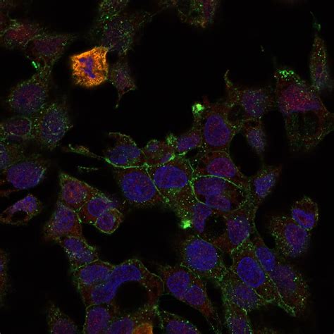 Nuclear Irf9 And Stat1 Quantification Image Analysis Image Sc Forum