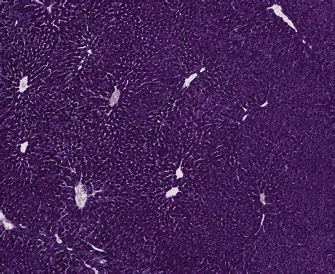 Aid In Analysis Of Pas Stained Slides Using Qupath Image Analysis Imagesc Forum