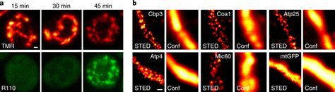 Distribution Of Oxphos Assembly Along The Mitochondrial Network A In Download Scientific