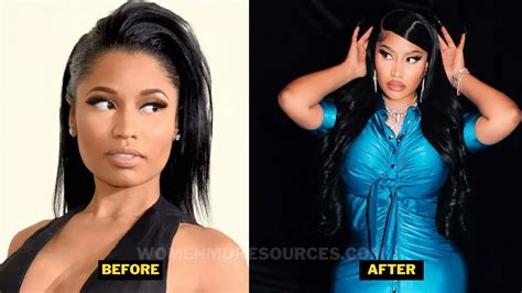Nicki Minaj Weight Gain Plastic Surgery Pregnancy And Before After