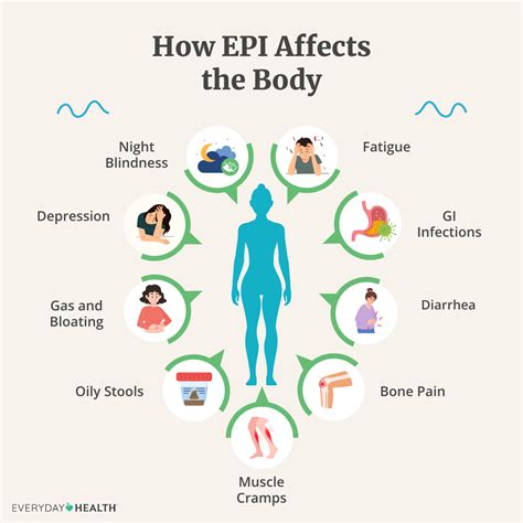 Faqs About Epi