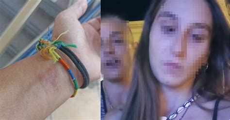 Rifiuta La Relazione Della Figlia Con Una Donna Il Padre Le Aggredisce