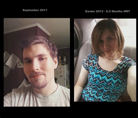 My Simple Before After 25 MTF Imgur