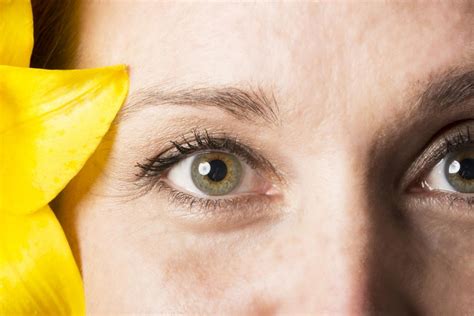 Central Heterochromia Two Different Eye Colors Causes And Types