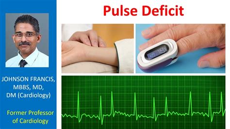 Pulse Deficit Youtube