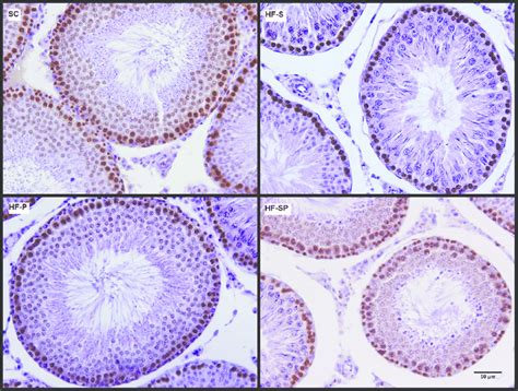 Photomicrographs Of The Proliferation Of A Spermatogenic Cell Line In Download Scientific