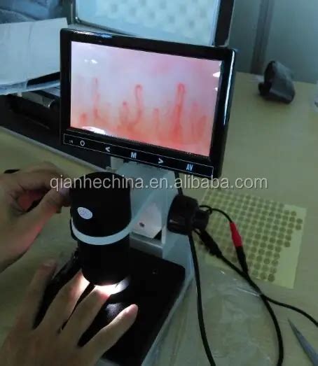 Professional Nailfold Capillary Microcirculation Microscope Test