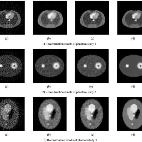 Emission Fbp Reconstruction And Bayesian Reconstructions Using Download Scientific Diagram