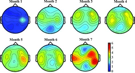 Topographies Of Alpha Band Power For Each Monthly Age First Row Shows