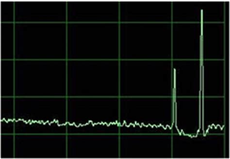Two Output Signals On An Oscilloscope After A Supersonic Projectile